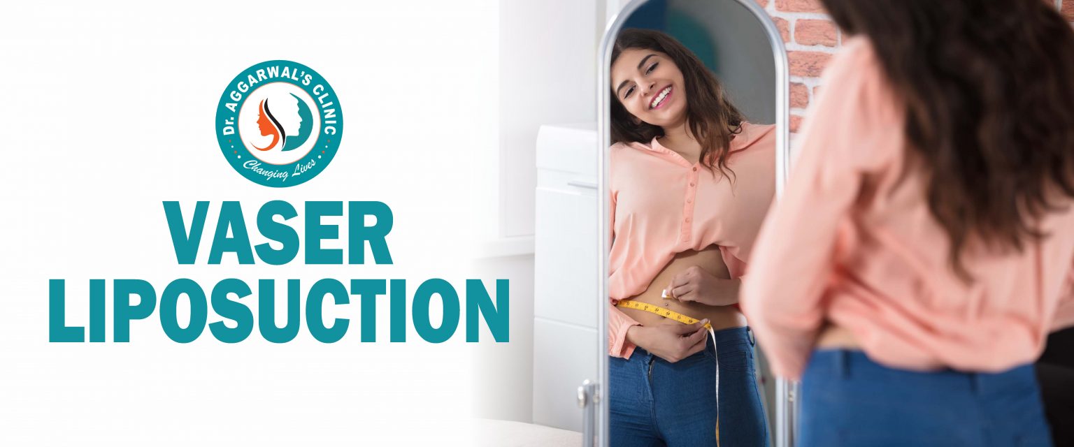 Vaser Liposuction in Jodhpur - DrAggarwalsClinic